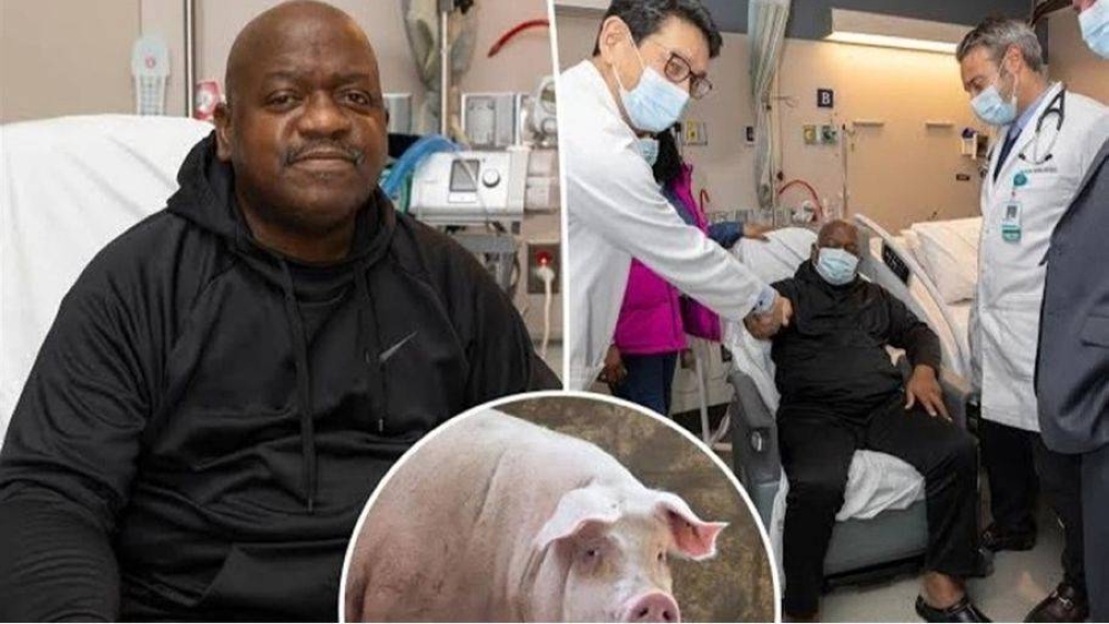 وفاة أول رجل خضع لعملية زراعة كلية من خنزير - أخبار السعودية | صحيفة عكاظ